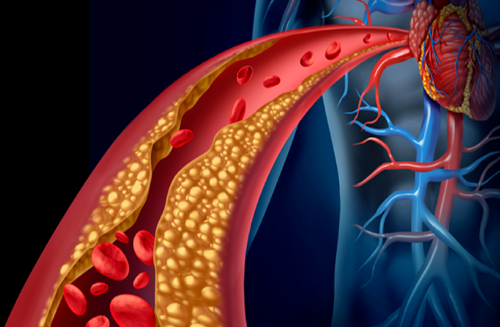Colesterol – ¡Bienvenidos a Conectando Juntos!